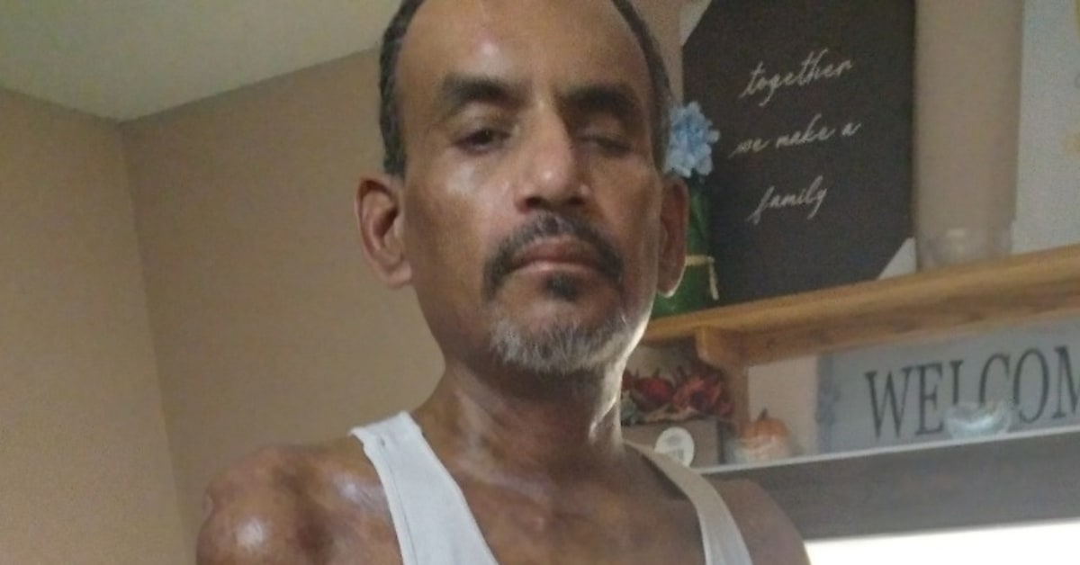 Mpd Man Missing After Discharge From North Memorial Hospital Bring