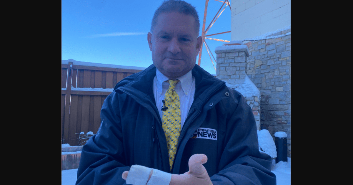 What happened to this KSTP meteorologist's hand? Station reveals all ...
