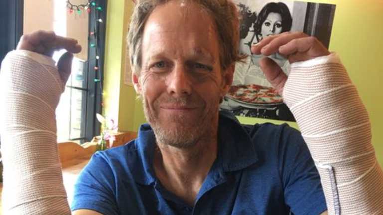 Professional Minnesota juggler Tuey Wilson breaks wrists during Duluth ...