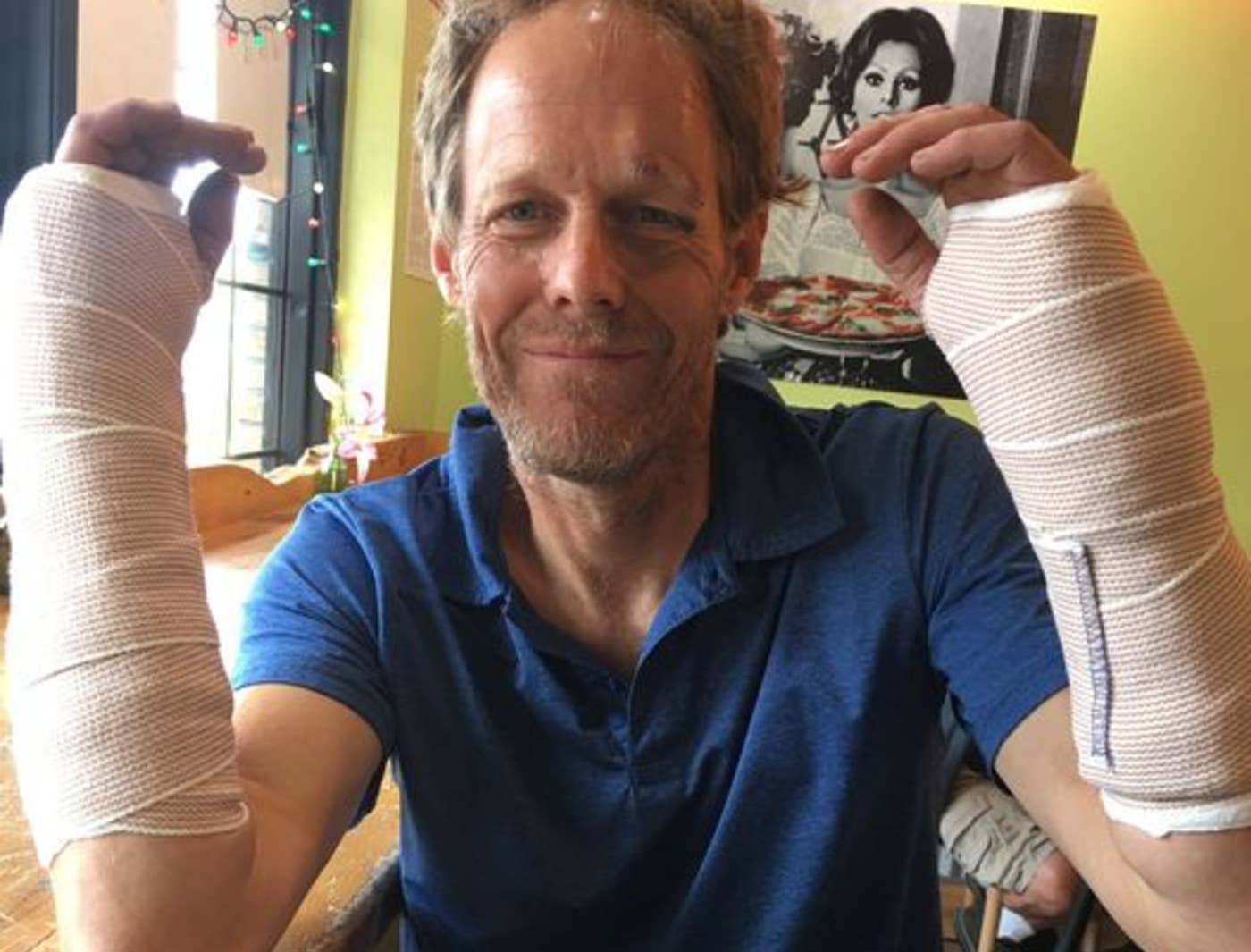 Professional Minnesota juggler Tuey Wilson breaks wrists during Duluth ...