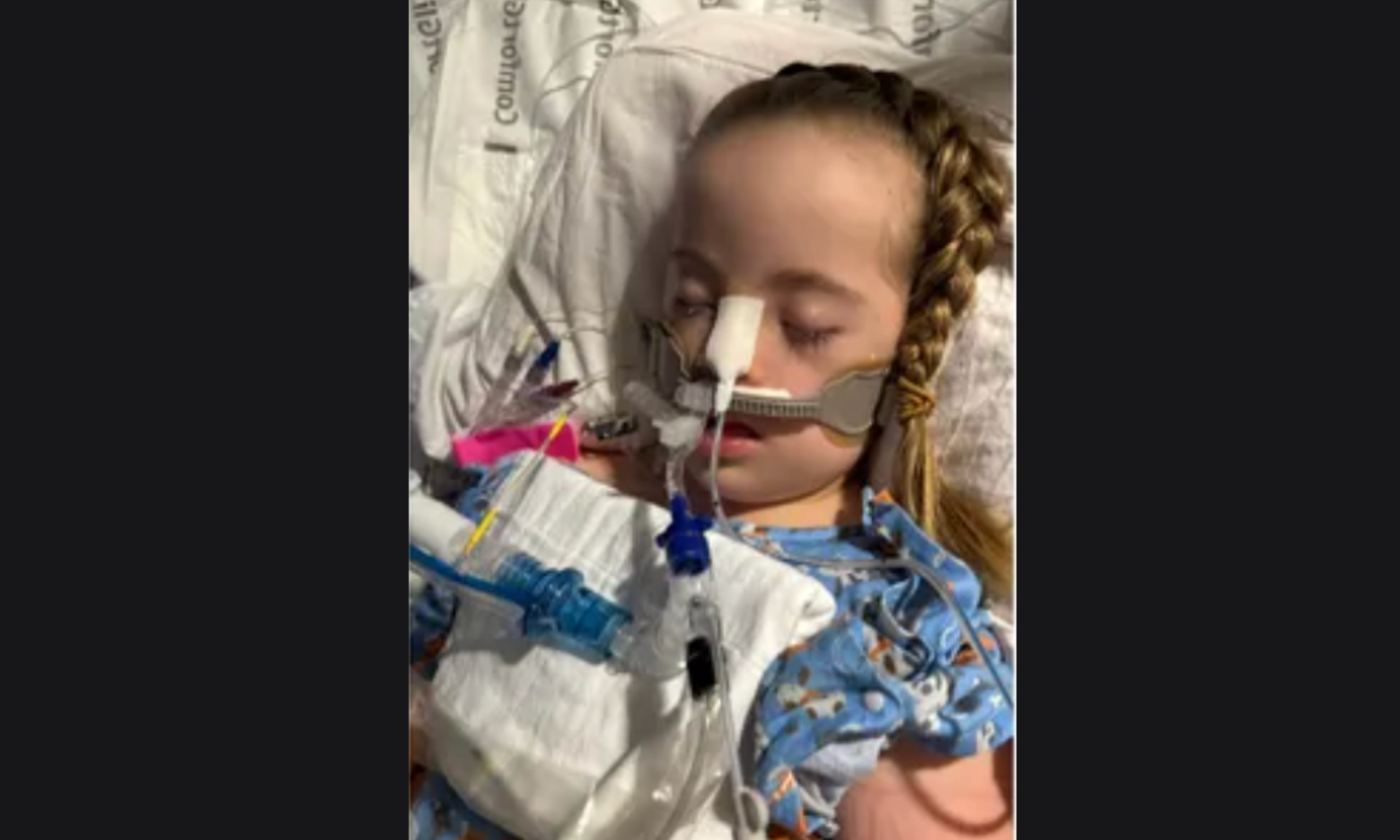Minnesota girl, 11, remains on ventilator as she battles severe flu ...