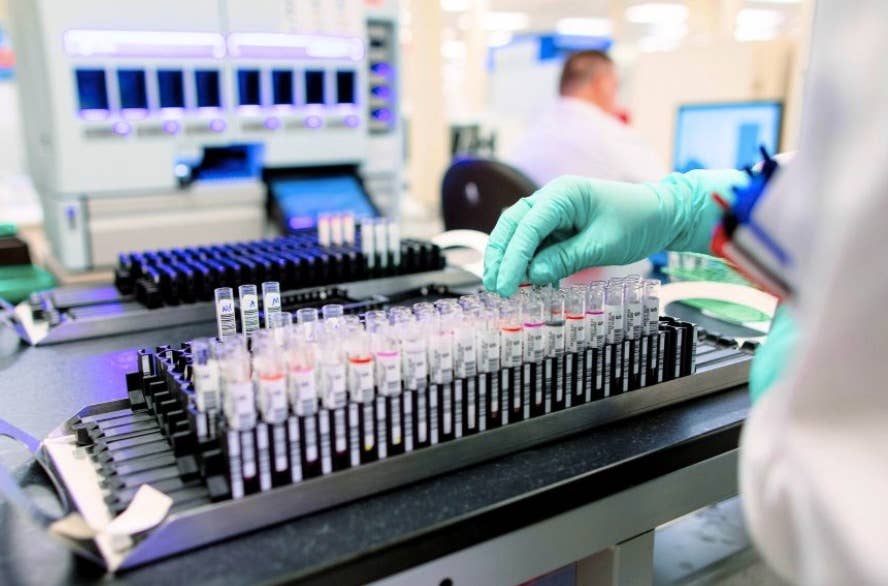 Coronavirus: Mayo Clinic, U of M are now offering antibody tests ...
